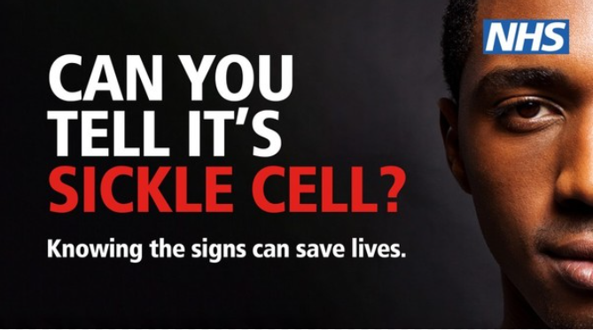 Social media assets | Can You Tell It's Sickle Cell? | Campaign ...