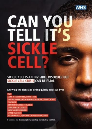 Posters | Can You Tell It's Sickle Cell? | Campaign Resource Centre