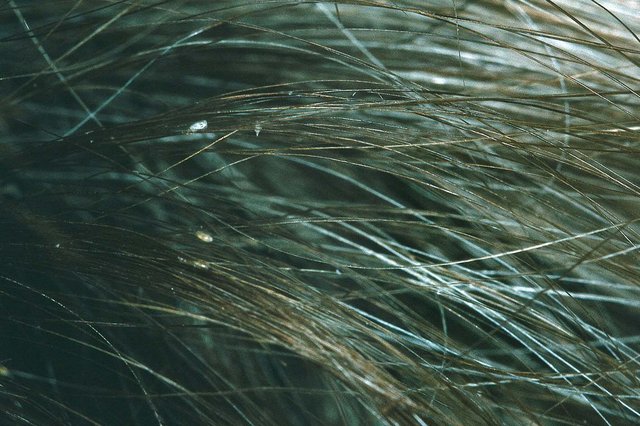Head lice and nits - NHS