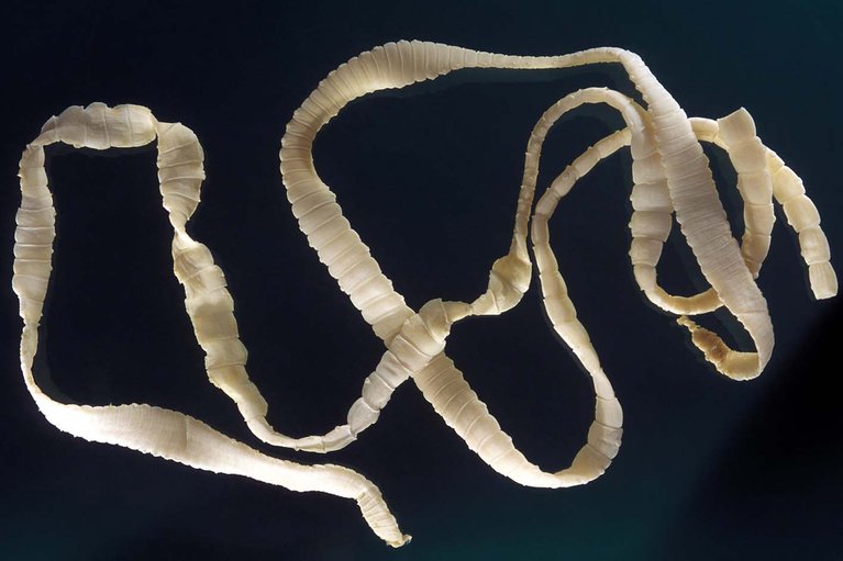 Worms in humans - NHS