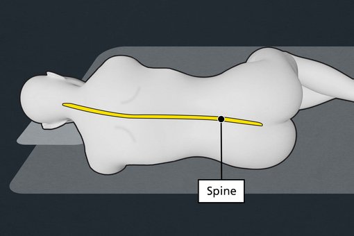 Lumbar puncture - NHS