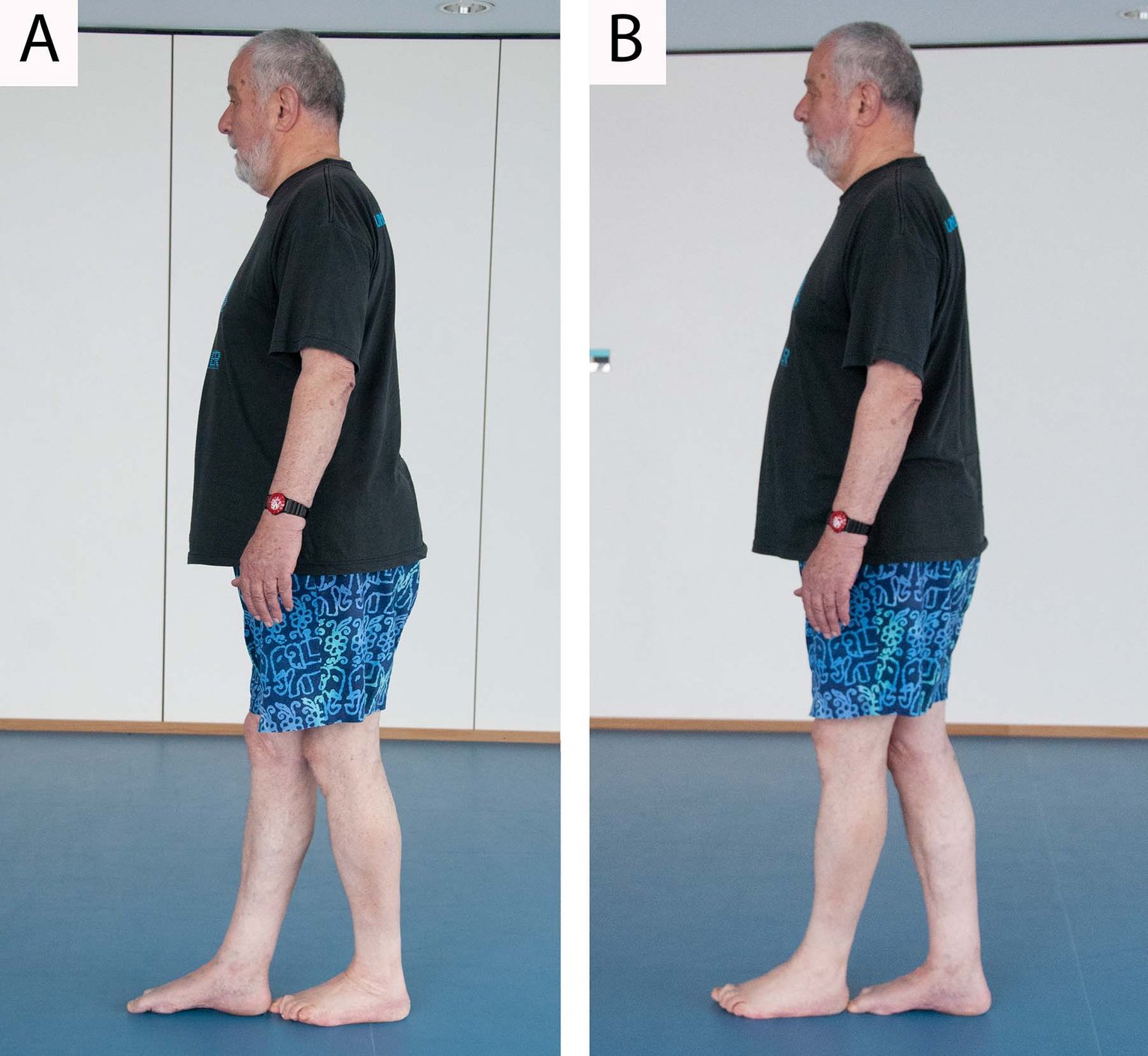 Balance exercises - NHS