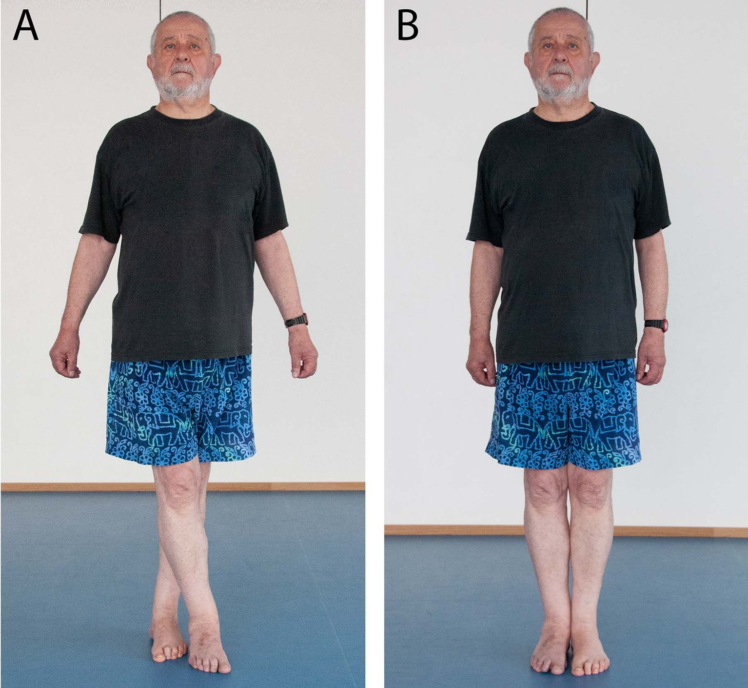 Balance exercises - NHS