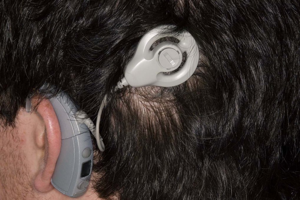 Hearing aids and implants - NHS