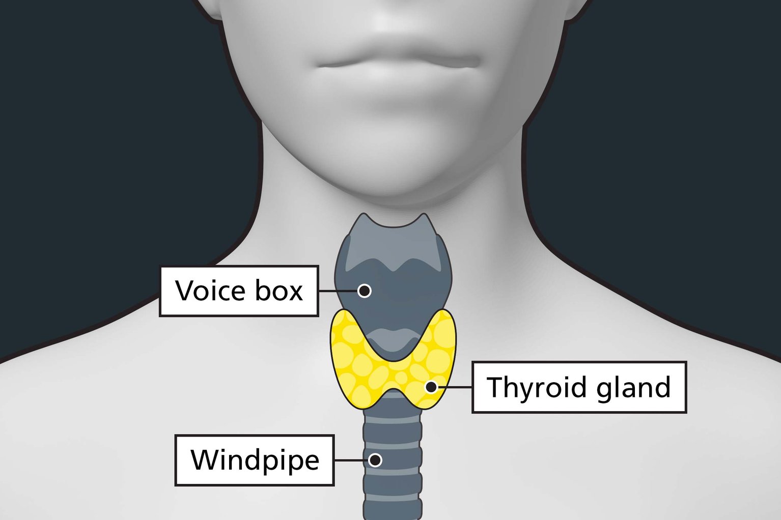 What is thyroid cancer? - NHS