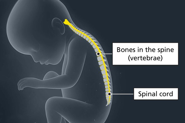 Spina bifida - NHS