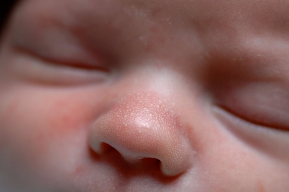 The Health Hub: Rashes in babies and children
